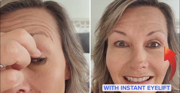 Instantly Look 10 Years Younger! This Instant Eyelift Works Like Magic ...